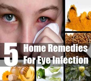 Home Remedies For Eye Infection - Natural Treatments And Cure For Eye ...